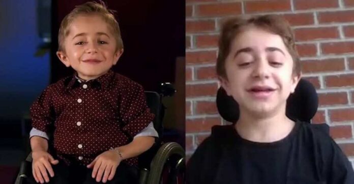 Kaleb-Wolf De Melo Torres From Shriners Hospital - A Comprehensive ...